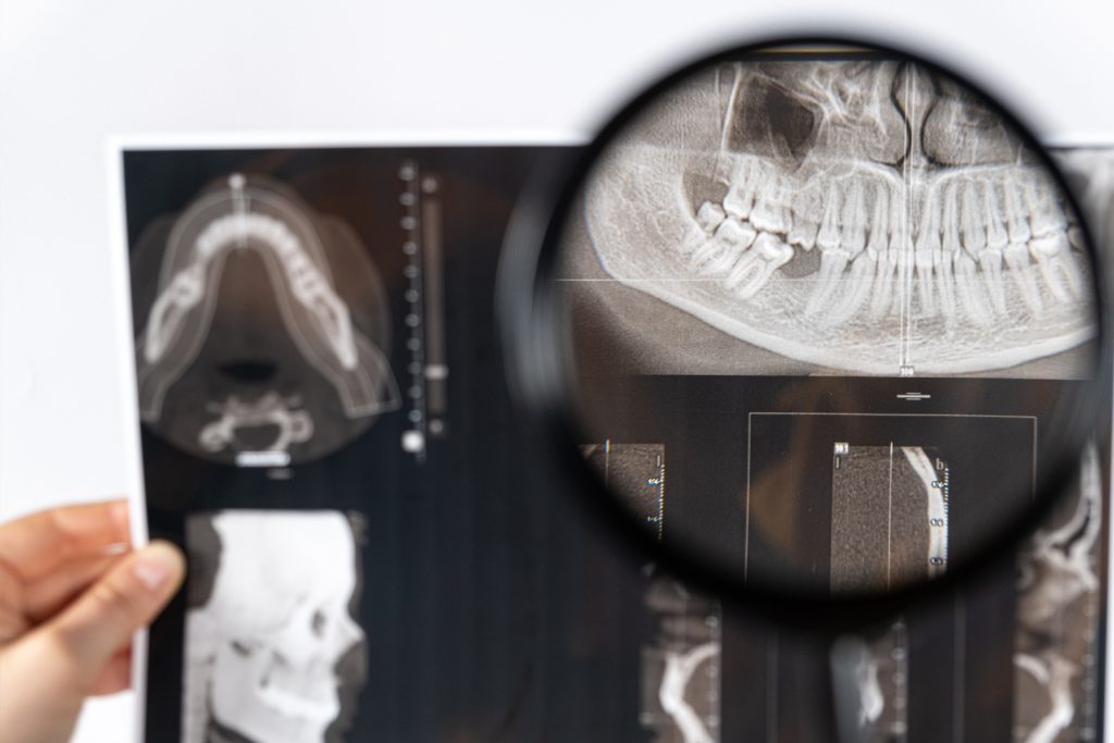 ΙΑΤΡΙΚΟ ΤΟΥΜΠΑΣ – ΔΙΑΓΝΩΣΤΙΚΟ ΚΕΝΤΡΟ